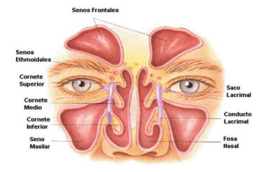 Sinusitis - tuSintoma.com