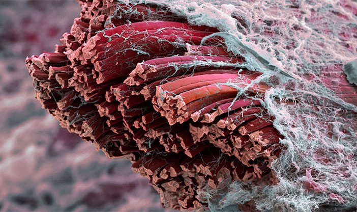 Agujetas - Definición, causas y remedios.