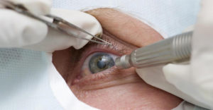 Nistagmo - Definición, causas y tratamiento.